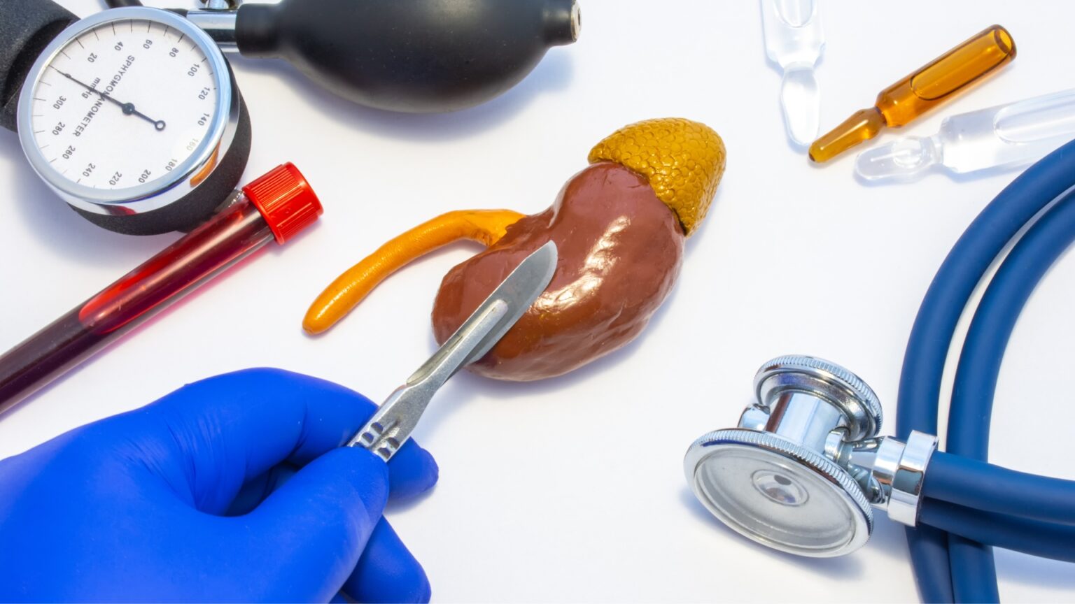 Nefrectomía laparoscópica: ¿Qué es y en qué consiste?